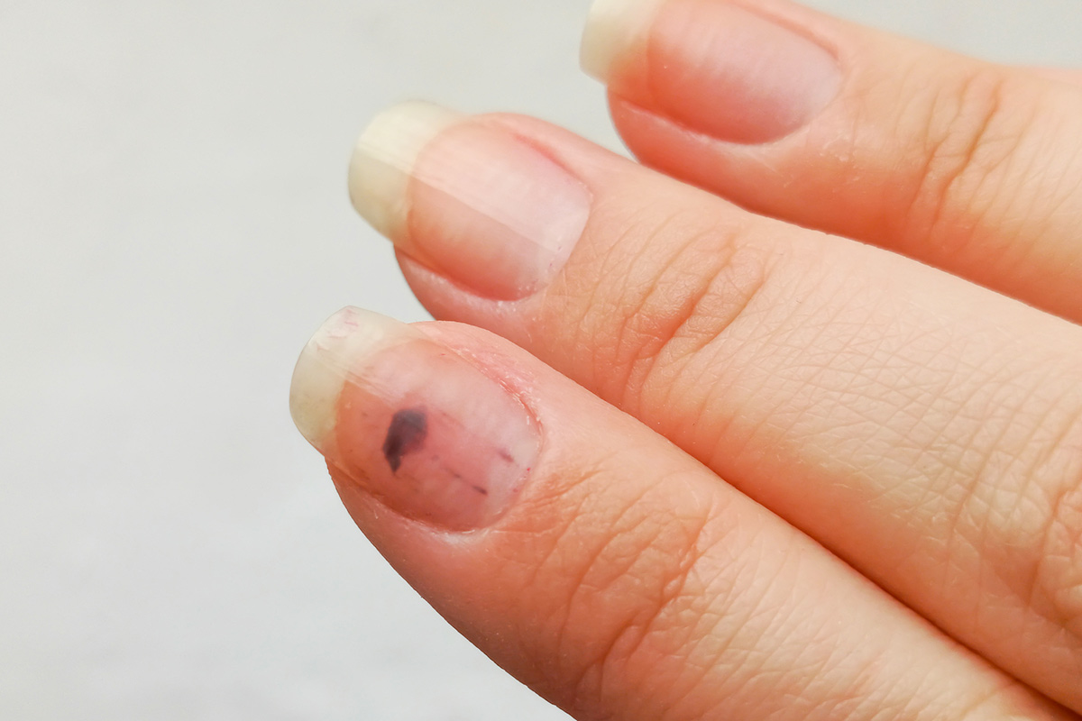 Why Do We Have Half-Moons on Our Fingernails? - Interesting Facts